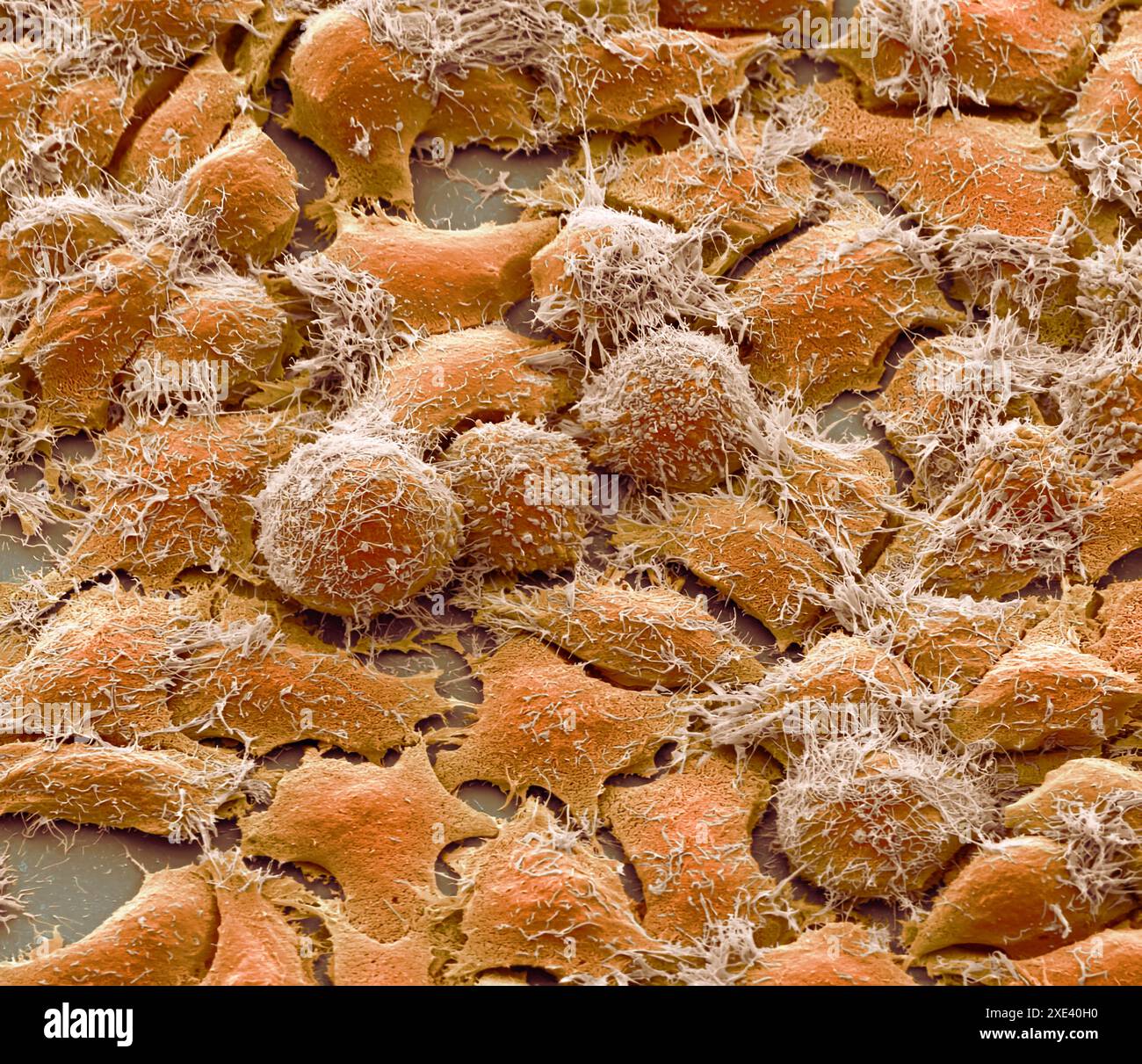 HeLa cells. Coloured scanning electron micrograph (SEM) of a HeLa cells ...