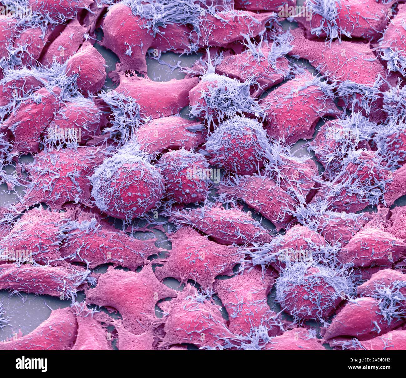HeLa cells. Coloured scanning electron micrograph (SEM) of a HeLa cells ...