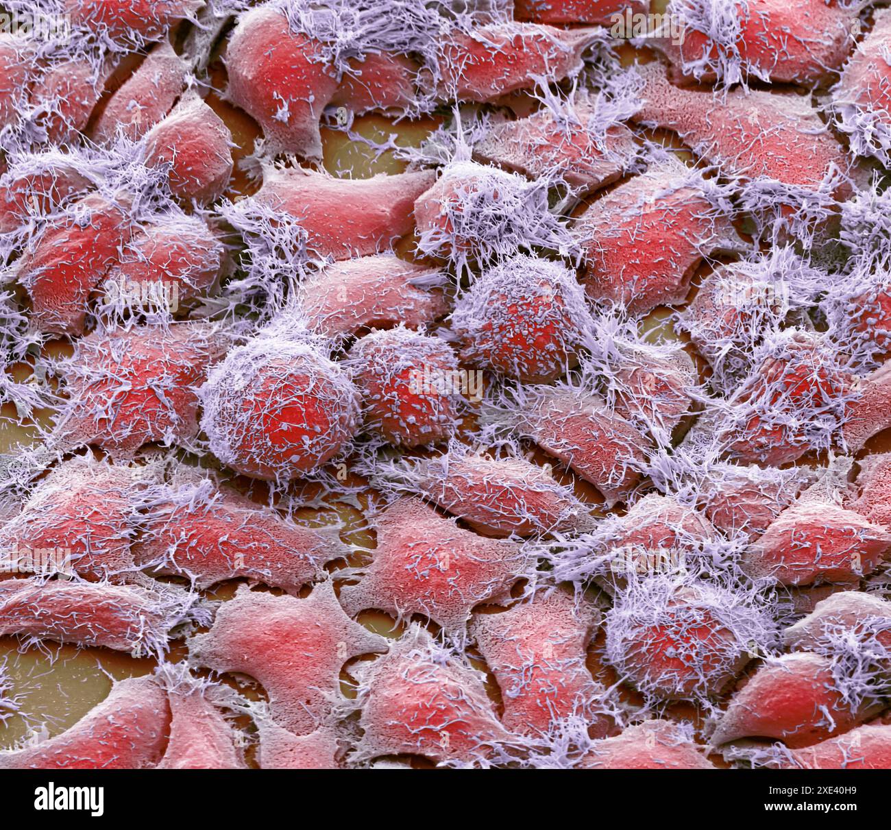 HeLa cells. Coloured scanning electron micrograph (SEM) of a HeLa cells ...