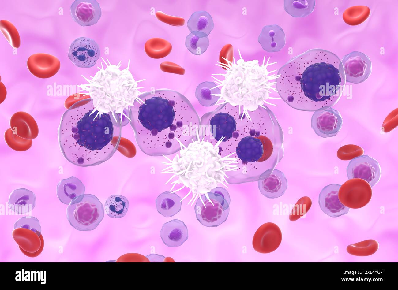Dendritic cells (DC) recognize Multiple myeloma (MM) - isometric view ...
