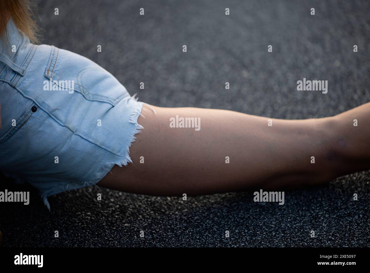 Leg bone and muscles pain, human anatomy Stock Photo - Alamy