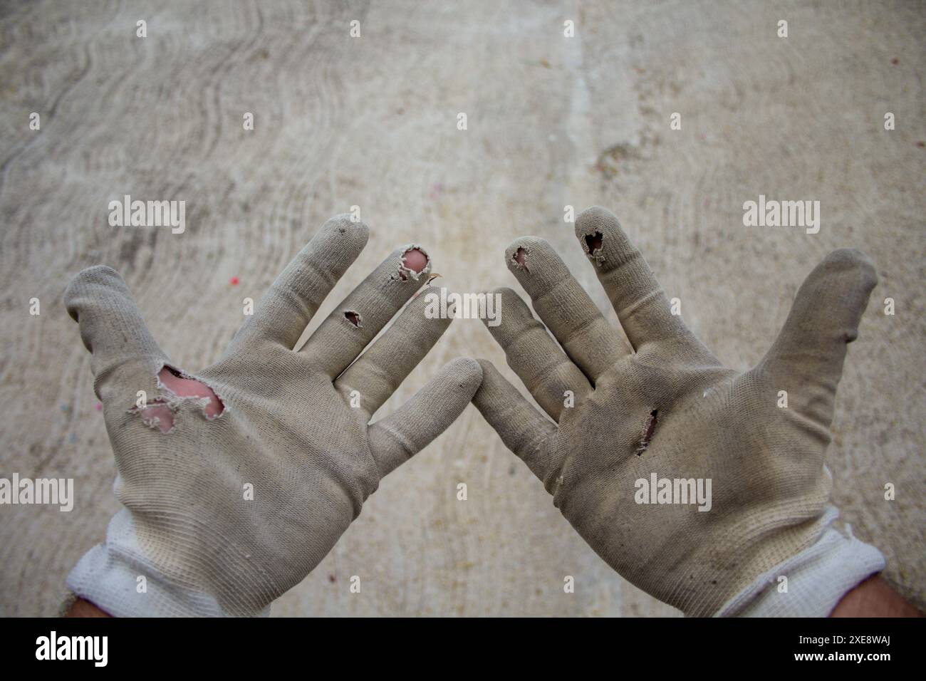 Image of a construction worker's hands with torn work gloves. Reference ...