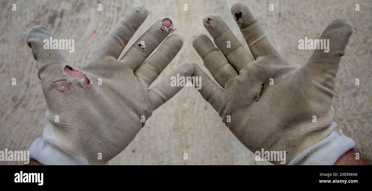 Image of a construction worker's hands with torn work gloves. Reference ...