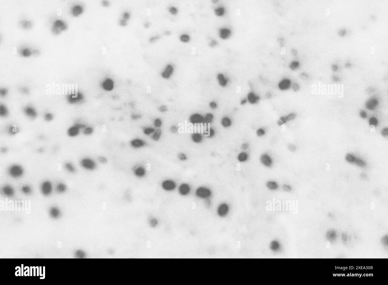 This microscope photo provided by the Centers for Disease Control and ...