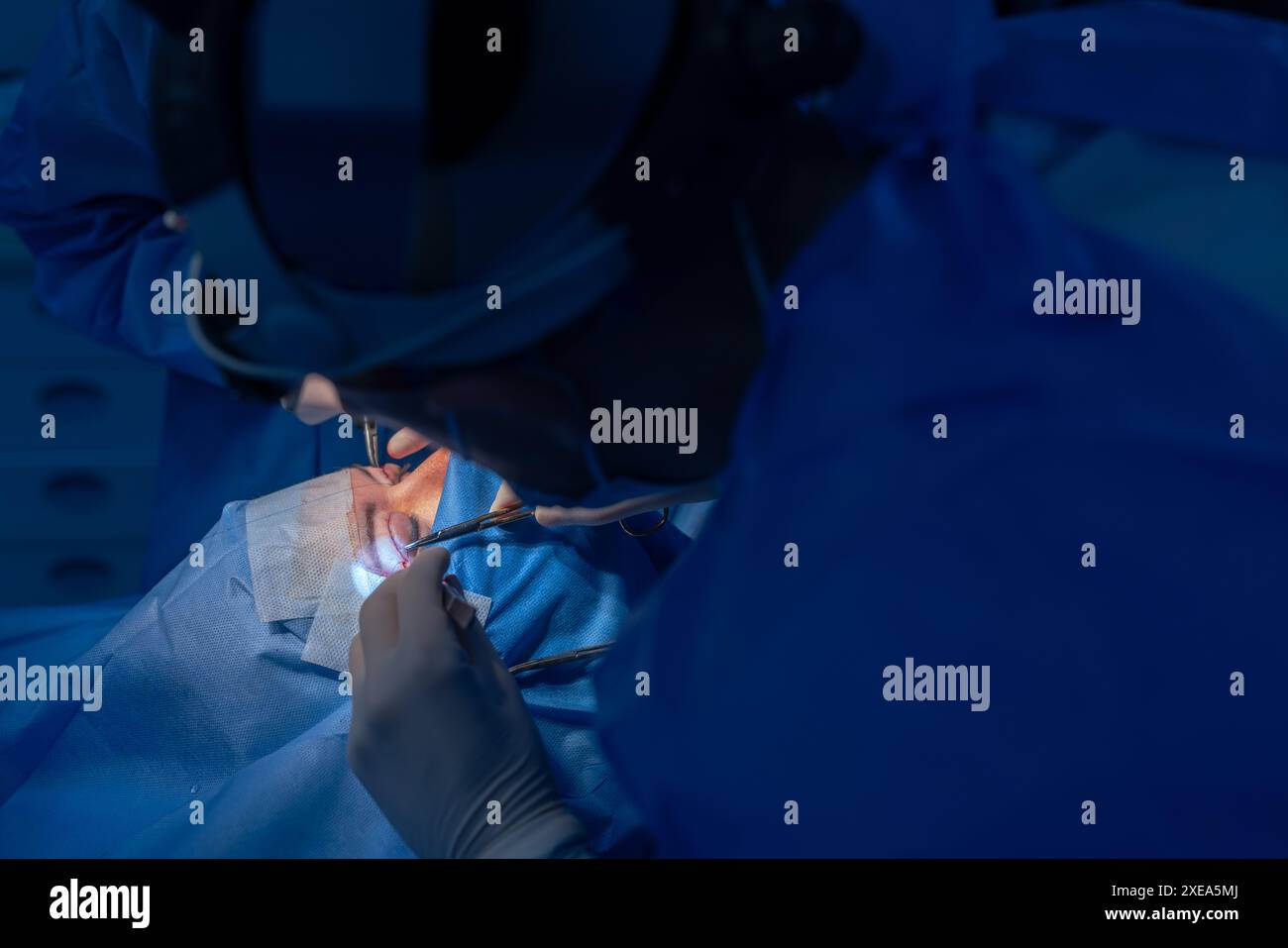 Blepharoplasty, plastic surgery to correct defects of the eyelids and ...