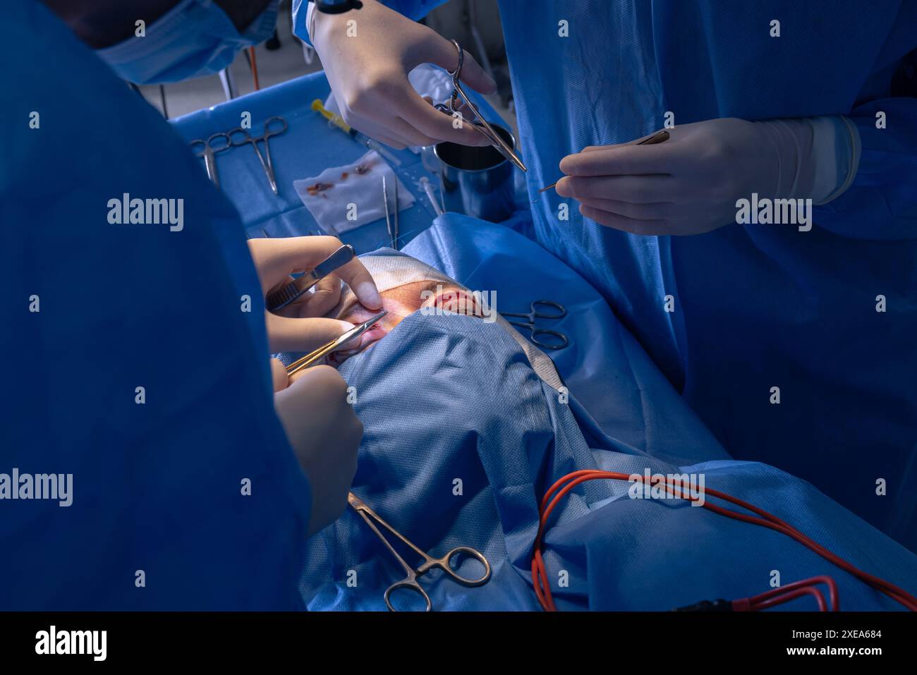 Blepharoplasty, plastic surgery to correct defects of the eyelids and ...