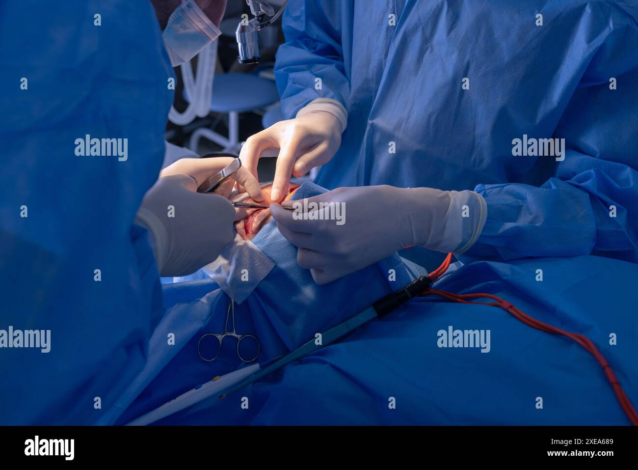 Blepharoplasty, plastic surgery to correct defects of the eyelids and ...