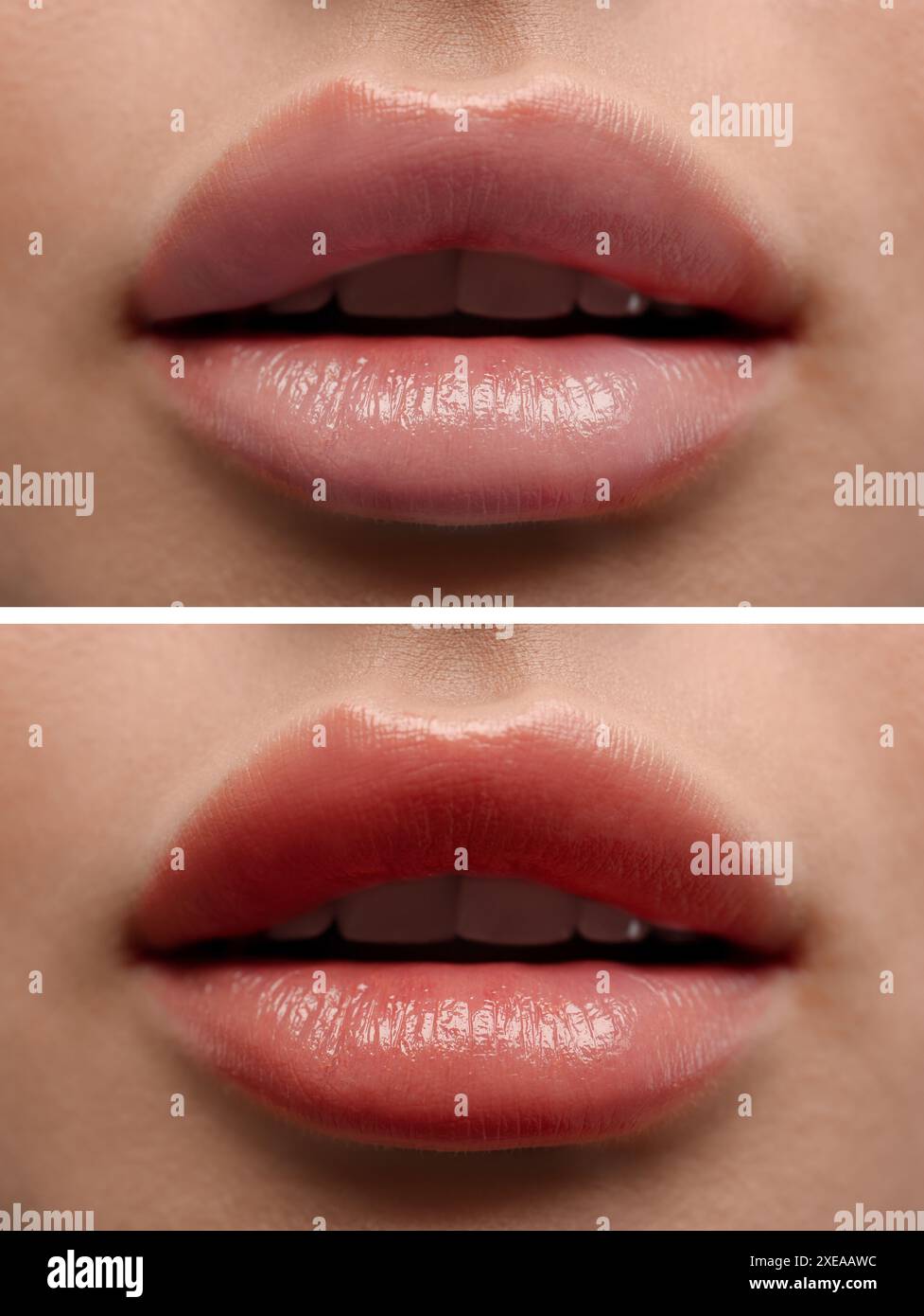 Permanent makeup. Collage with photos of woman before and after lip ...