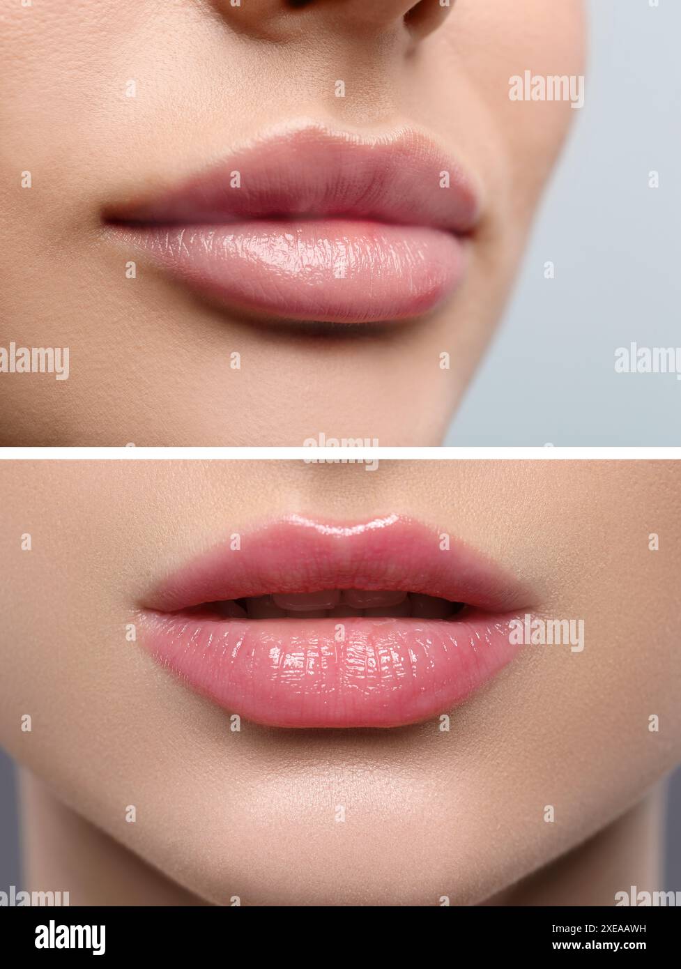 Permanent makeup. Collage with photos of woman before and after lip ...