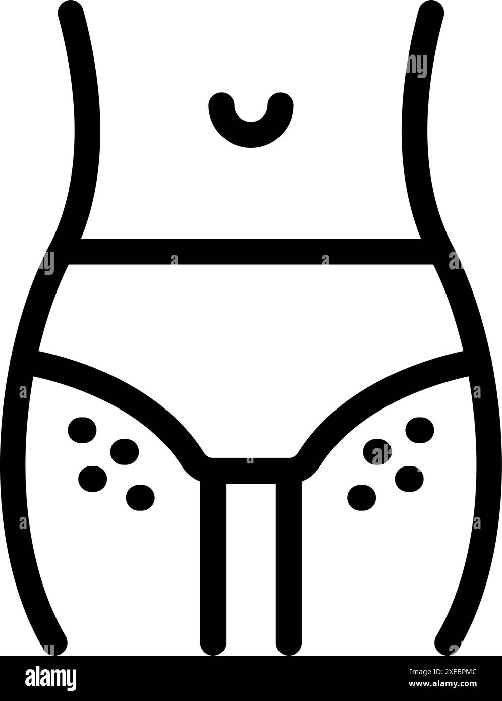 Woman body presenting cellulite, a skin condition causing dimpled ...