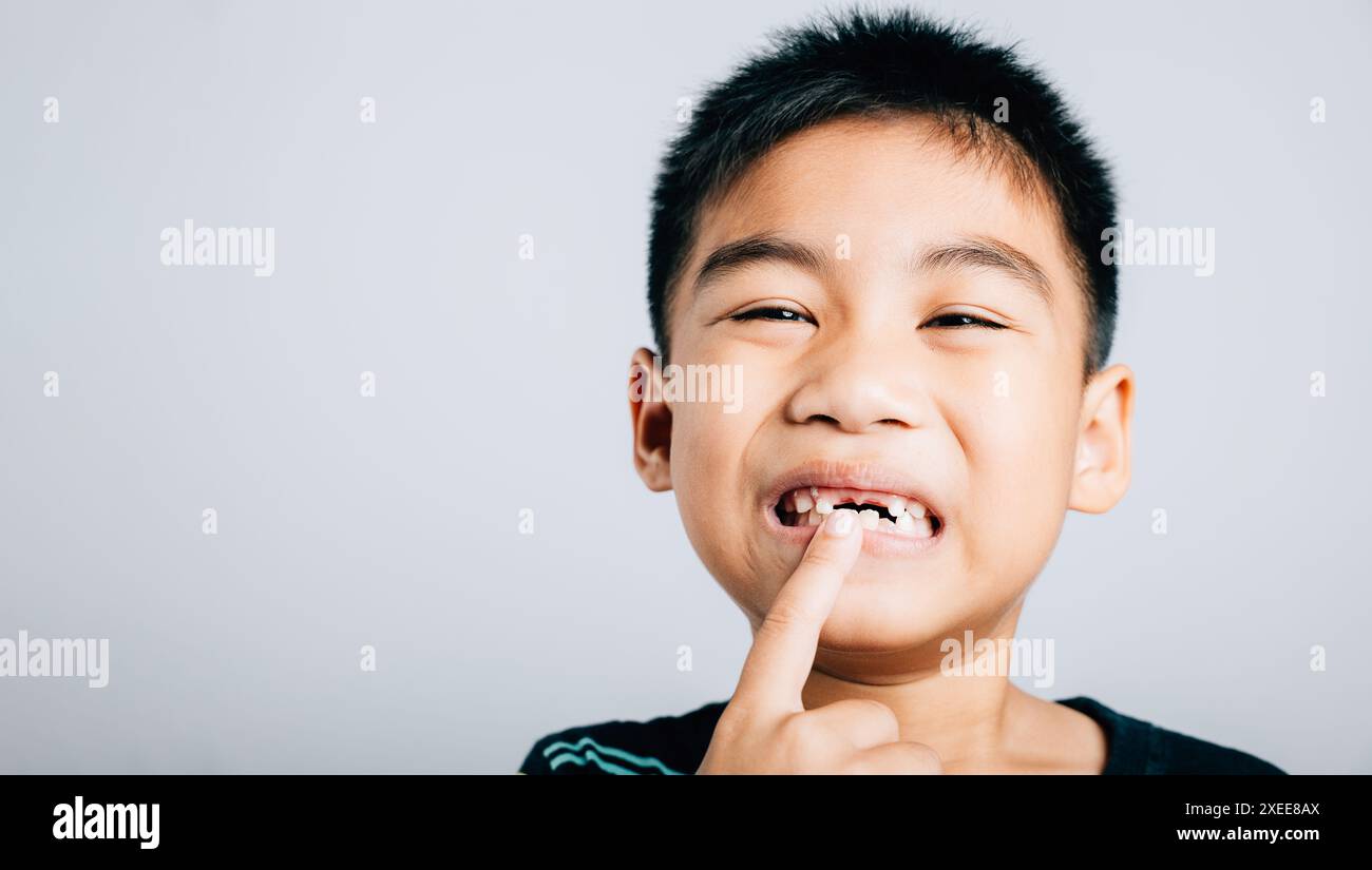 Preschooler wide grin shows growing molar gap signifying child dental ...