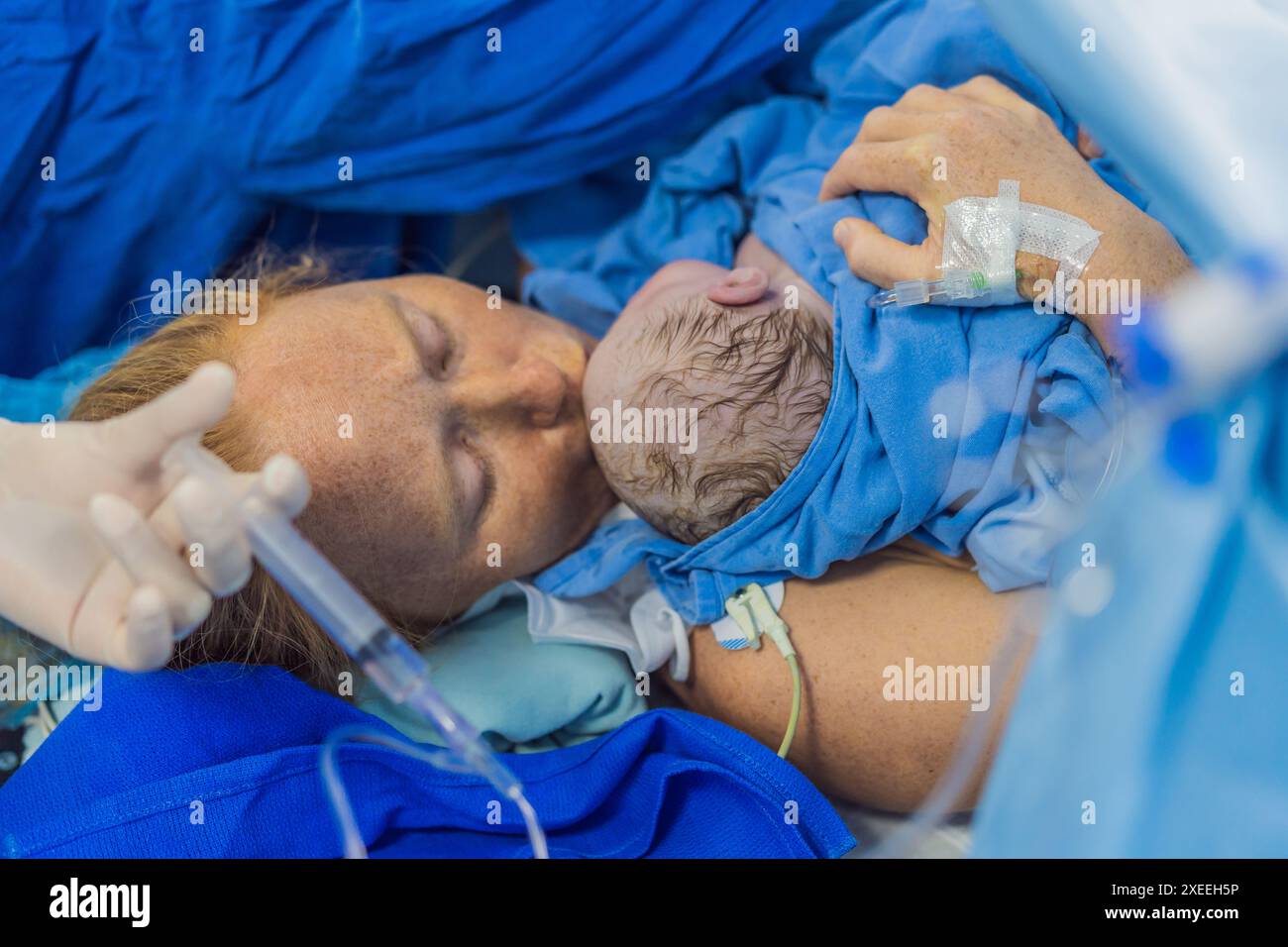 Baby on mother's chest immediately after birth in a hospital. The mother and newborn share a ...