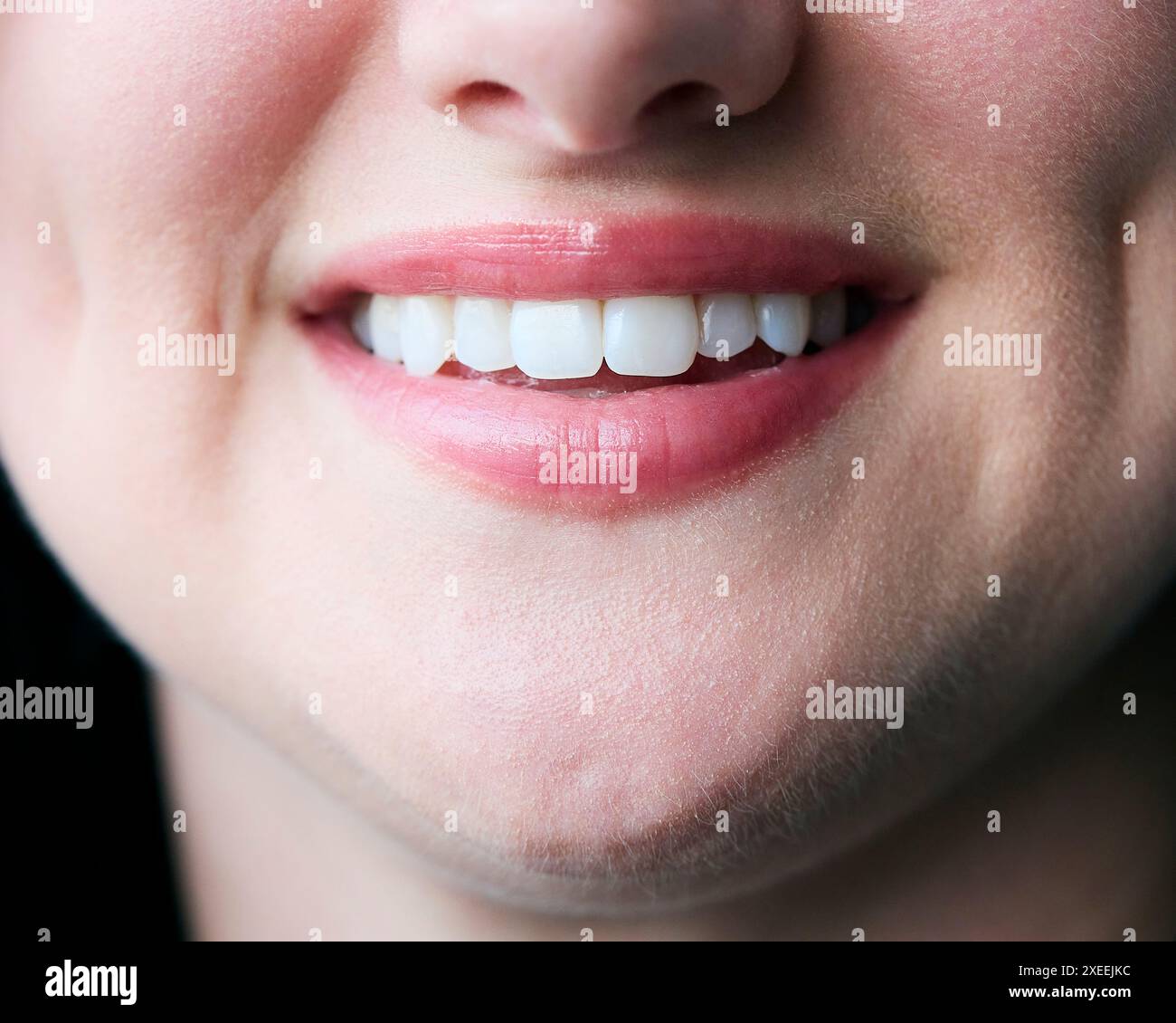 Macro Studio Expression Shot Of Woman's Mouth With Close Up On Lips And ...
