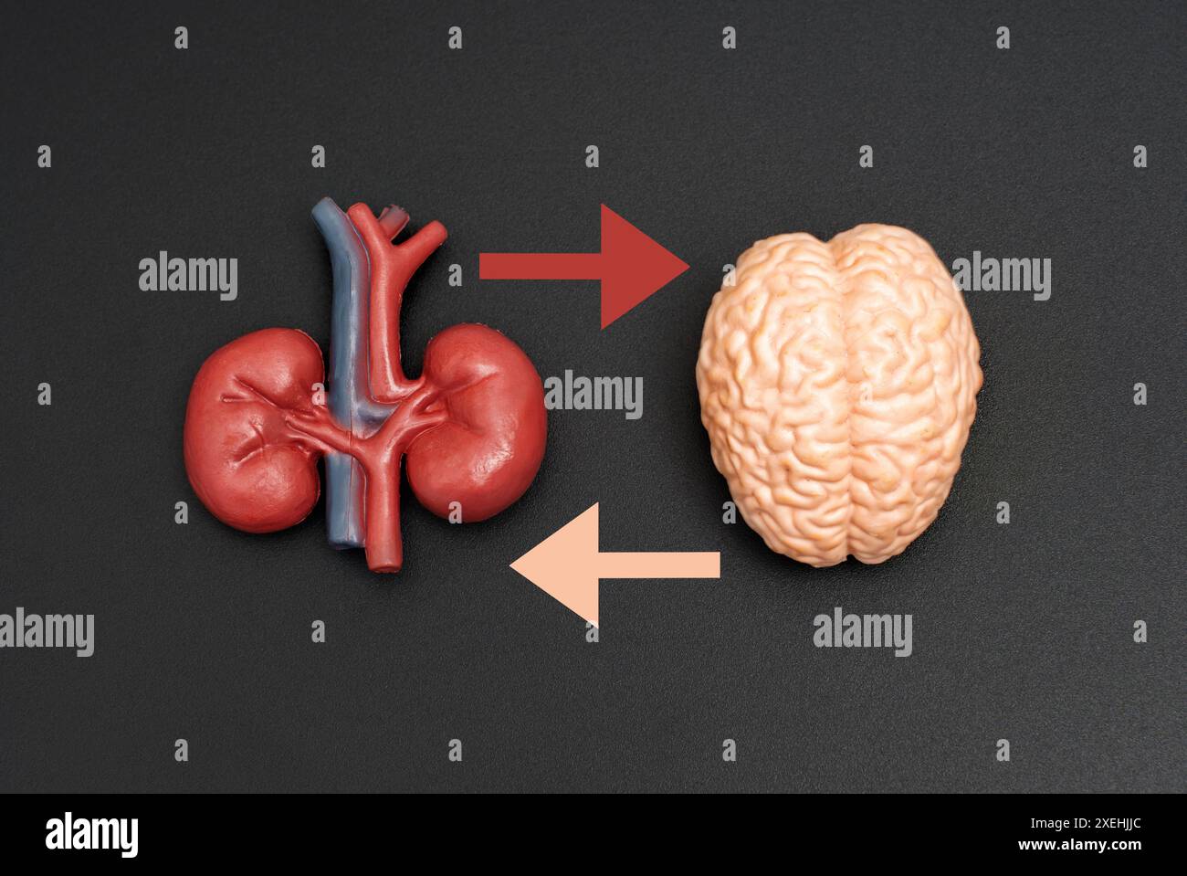 Realistic human brain and kidneys models connected by bilateral arrows ...