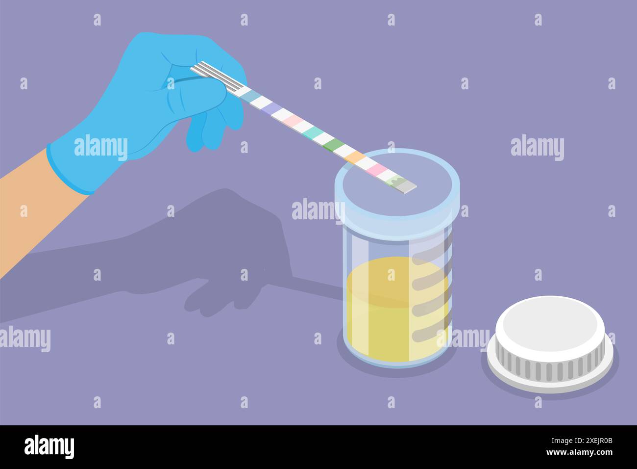 3D Isometric Flat Conceptual Illustration of Urine Analysis, Lab Test ...