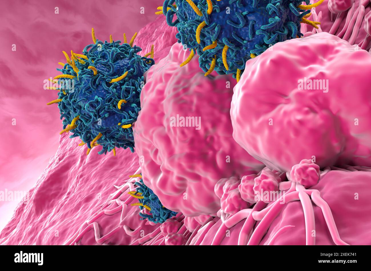 CAR T cell therapy in Thyroid cancer - closeup view 3d illustration ...