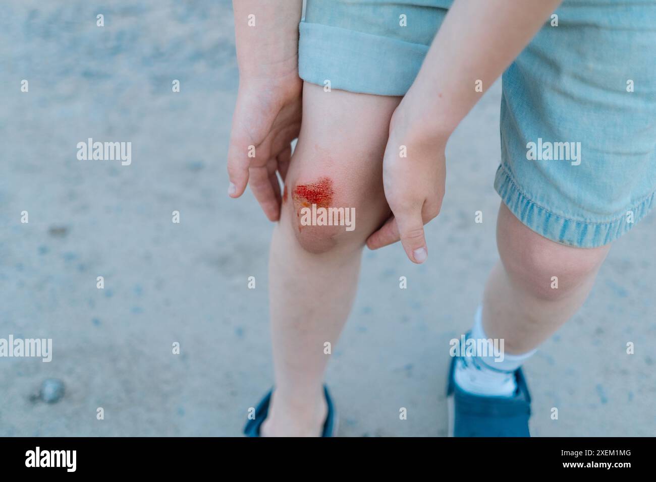 Close up knee visible hi-res stock photography and images - Alamy