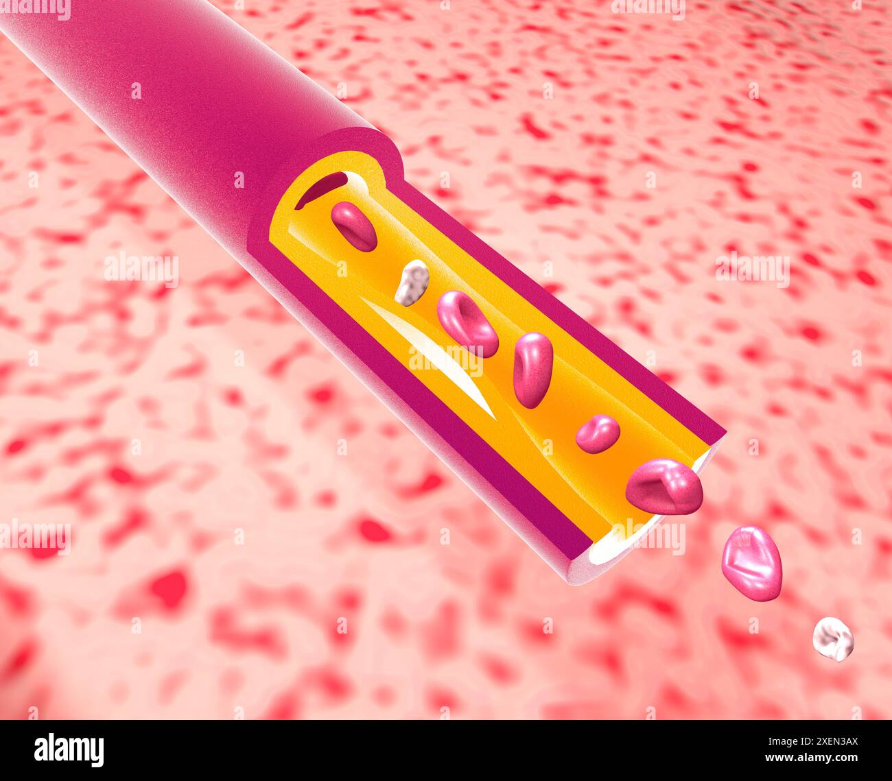 Anatomical 3D illustration of artery capillary with fat obstruction ...