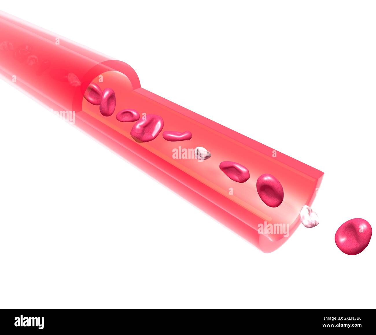 Anatomical 3D illustration of an artery that is becoming blocked by ...