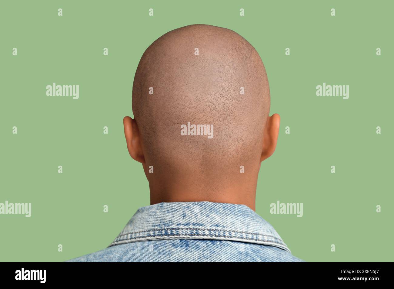 Back view young bald caucasian hi-res stock photography and images - Alamy