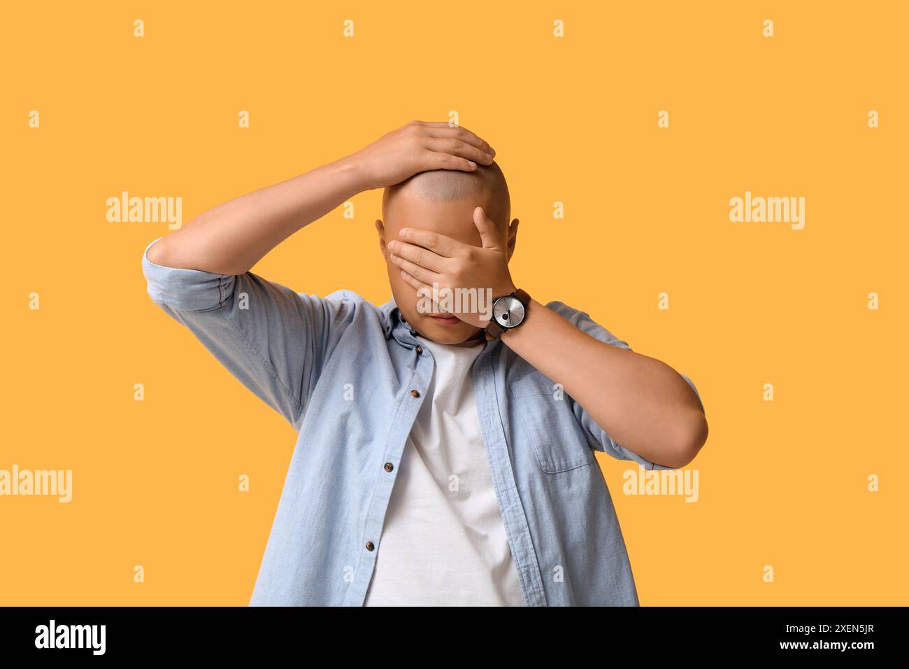 Stressed bald young man on yellow background Stock Photo - Alamy