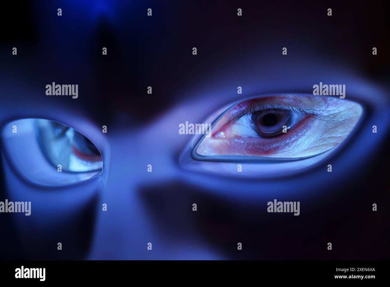 The woman's eyes are visible through the opening of a light therapy ...