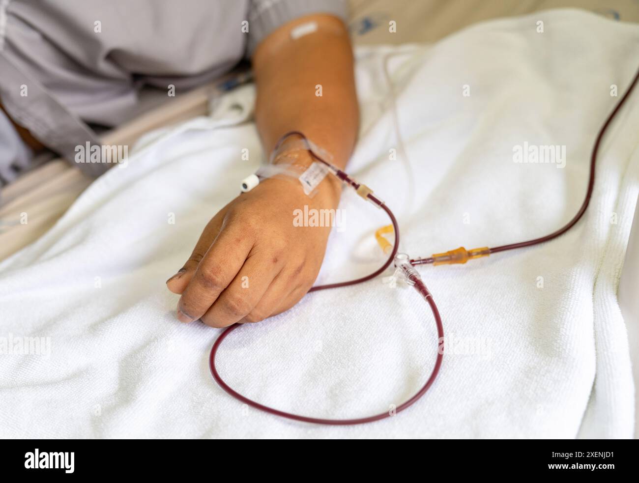 Patient receiving blood transfusion hi-res stock photography and images ...