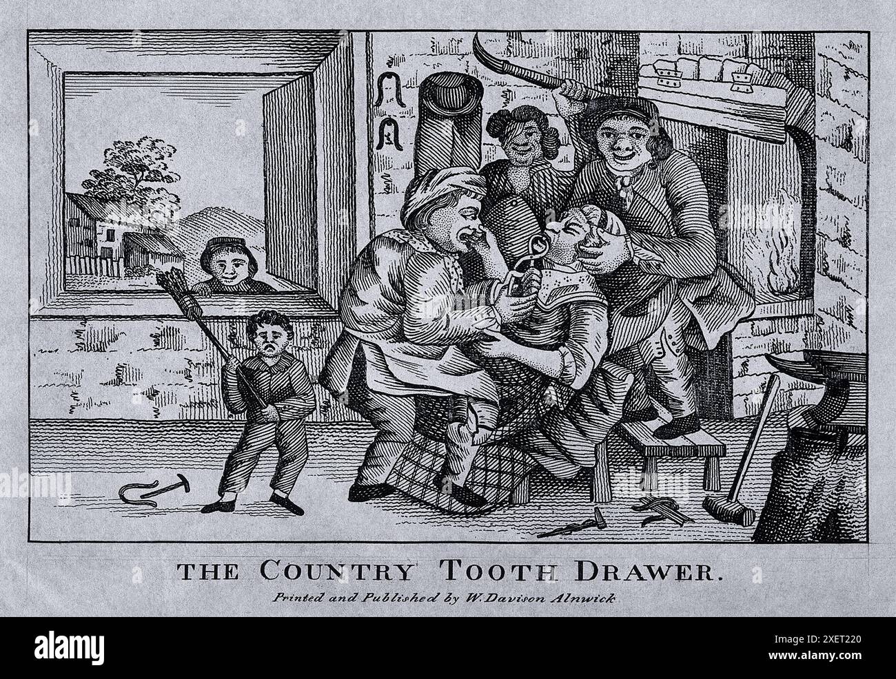Tooth extraction 18th century hi-res stock photography and images - Alamy