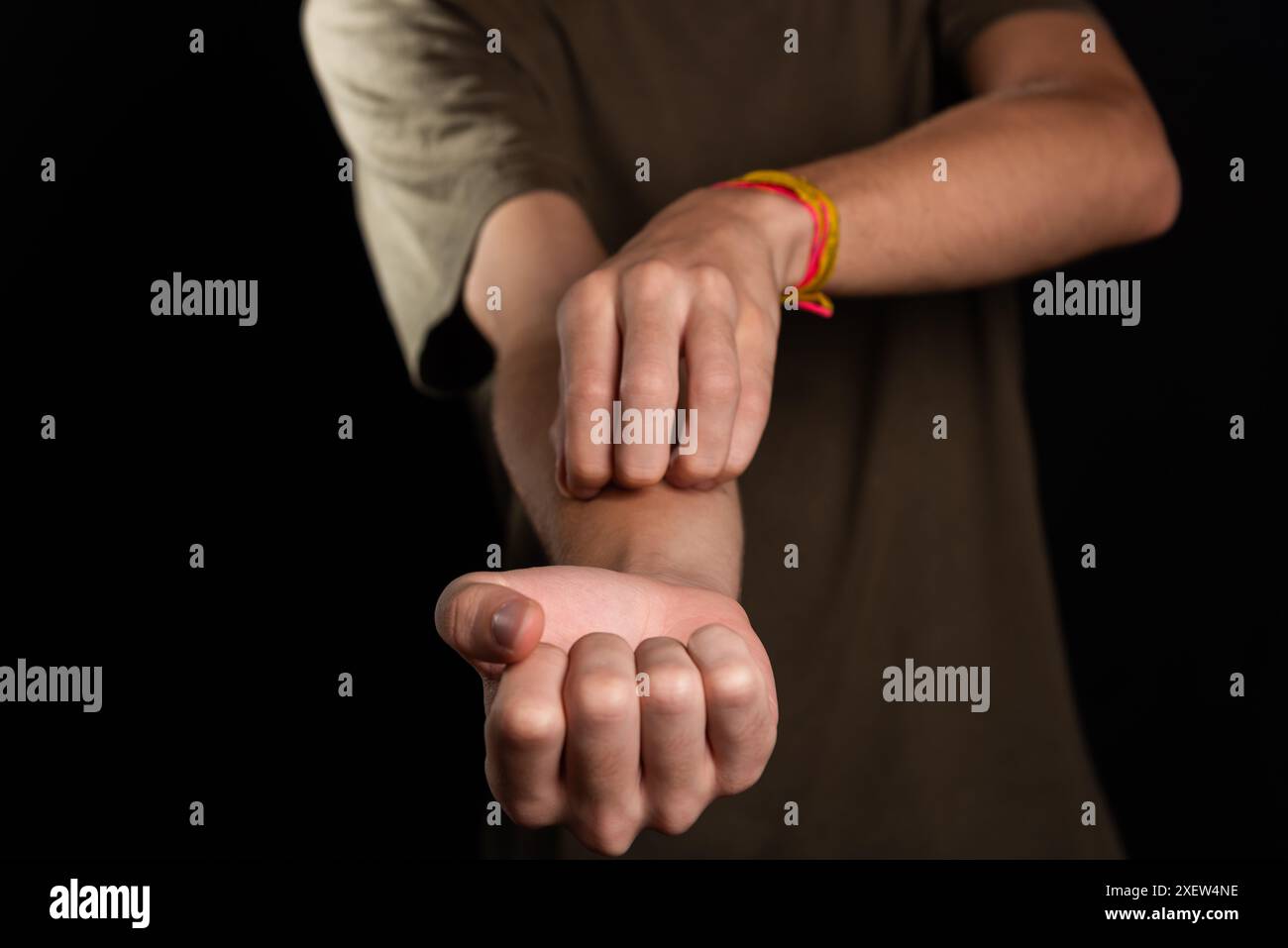 Young man scratching his arm with his hand. Skin disease. Irritation ...