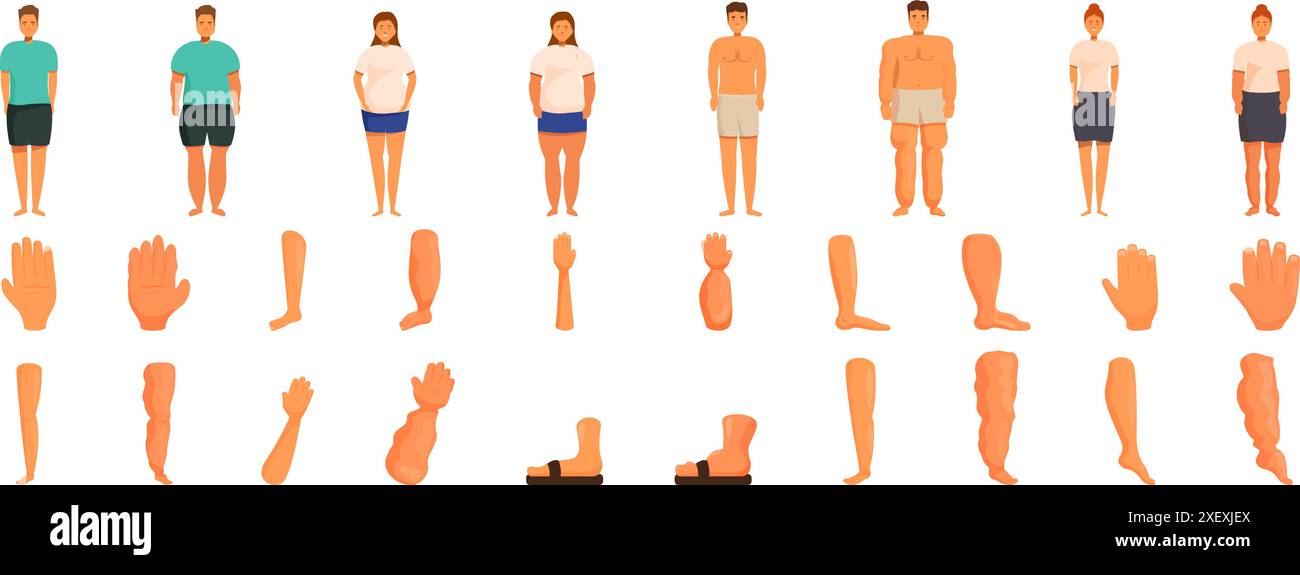 Edema icons set. People standing showing different body parts posing ...
