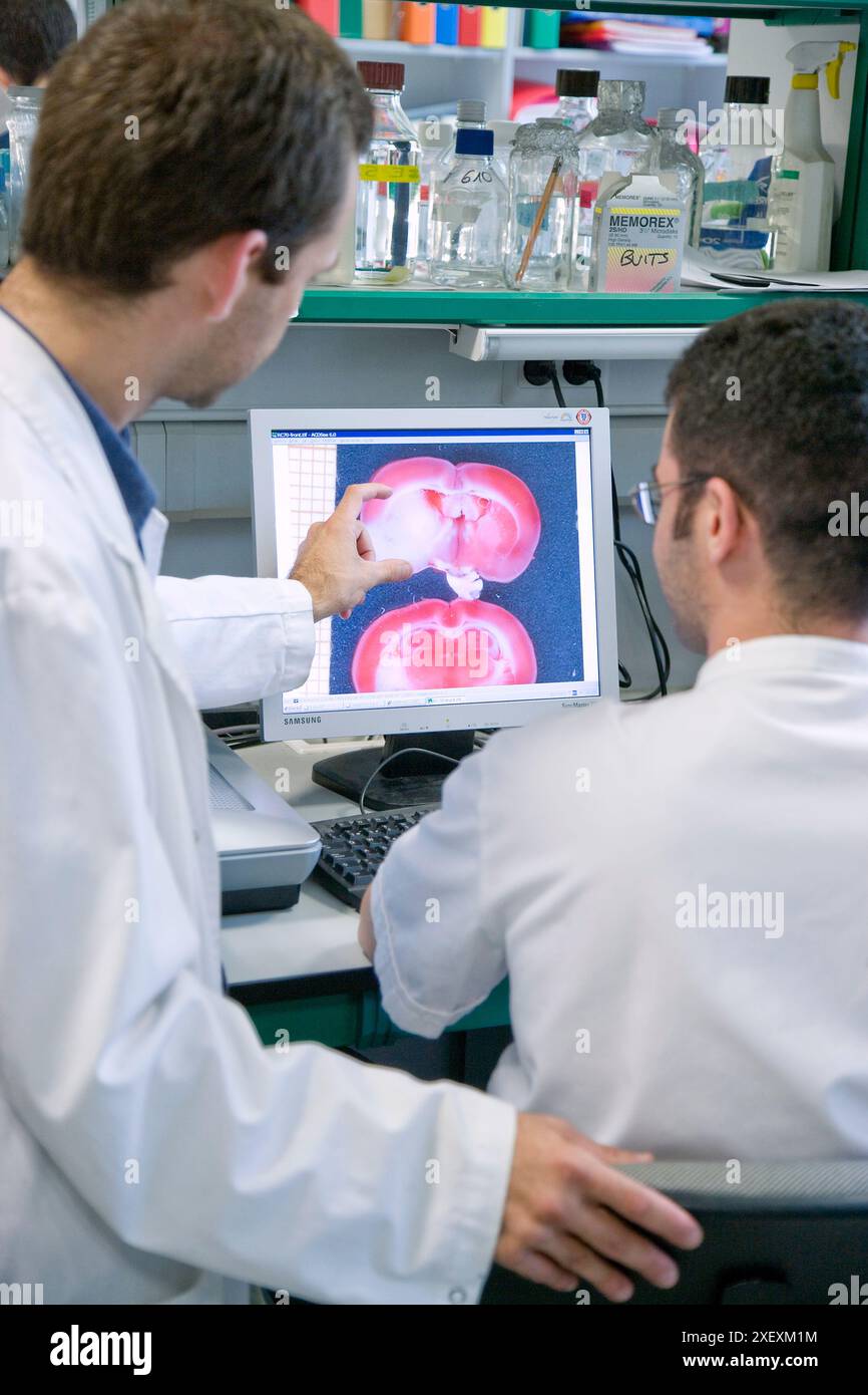 Brain Ischemia and Neurodegeneration, IIBB, Institute for Biomedical ...