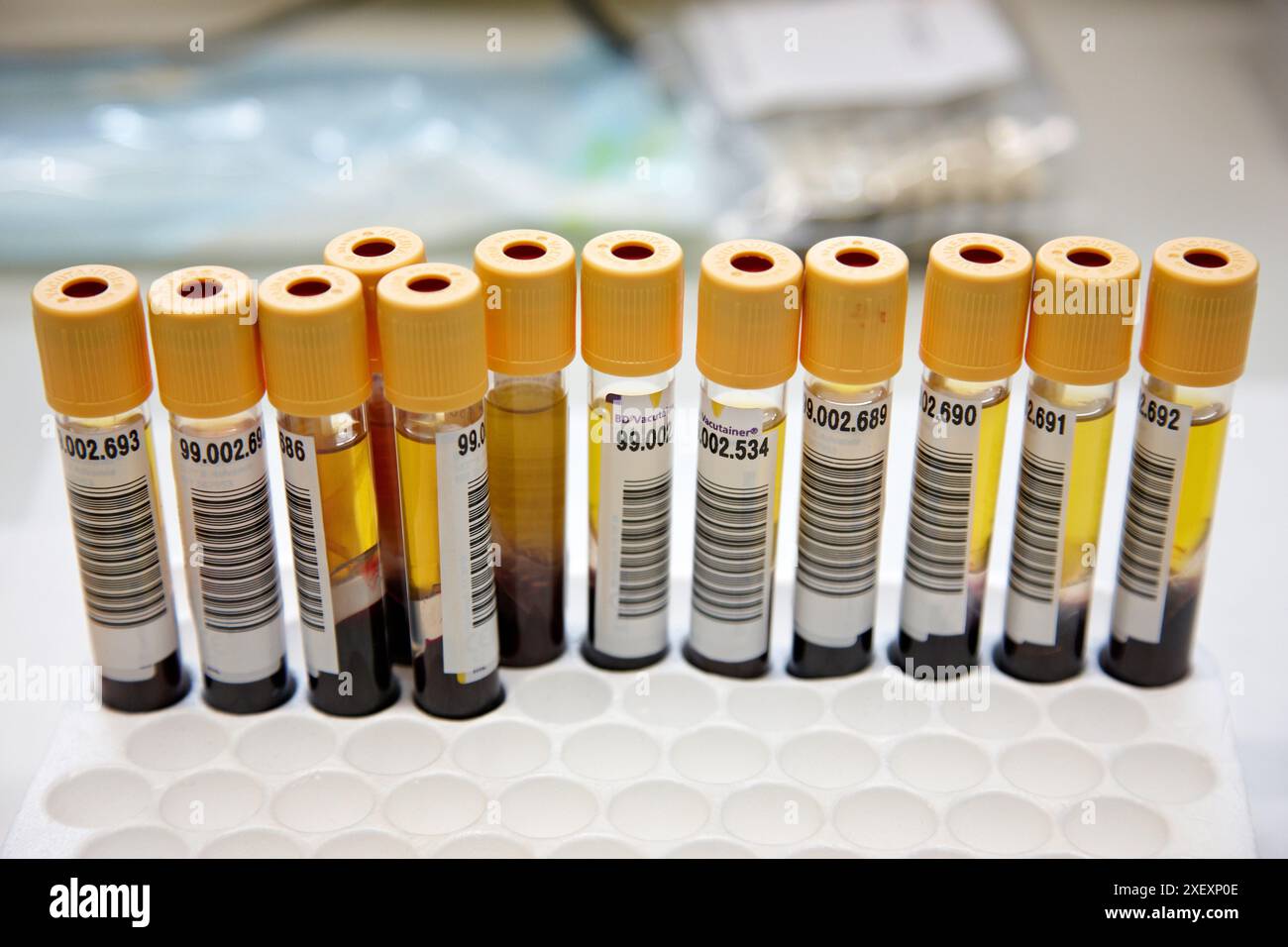 Blood samples, DNA and RNA biobank, extraction and storage of DNA/RNA ...