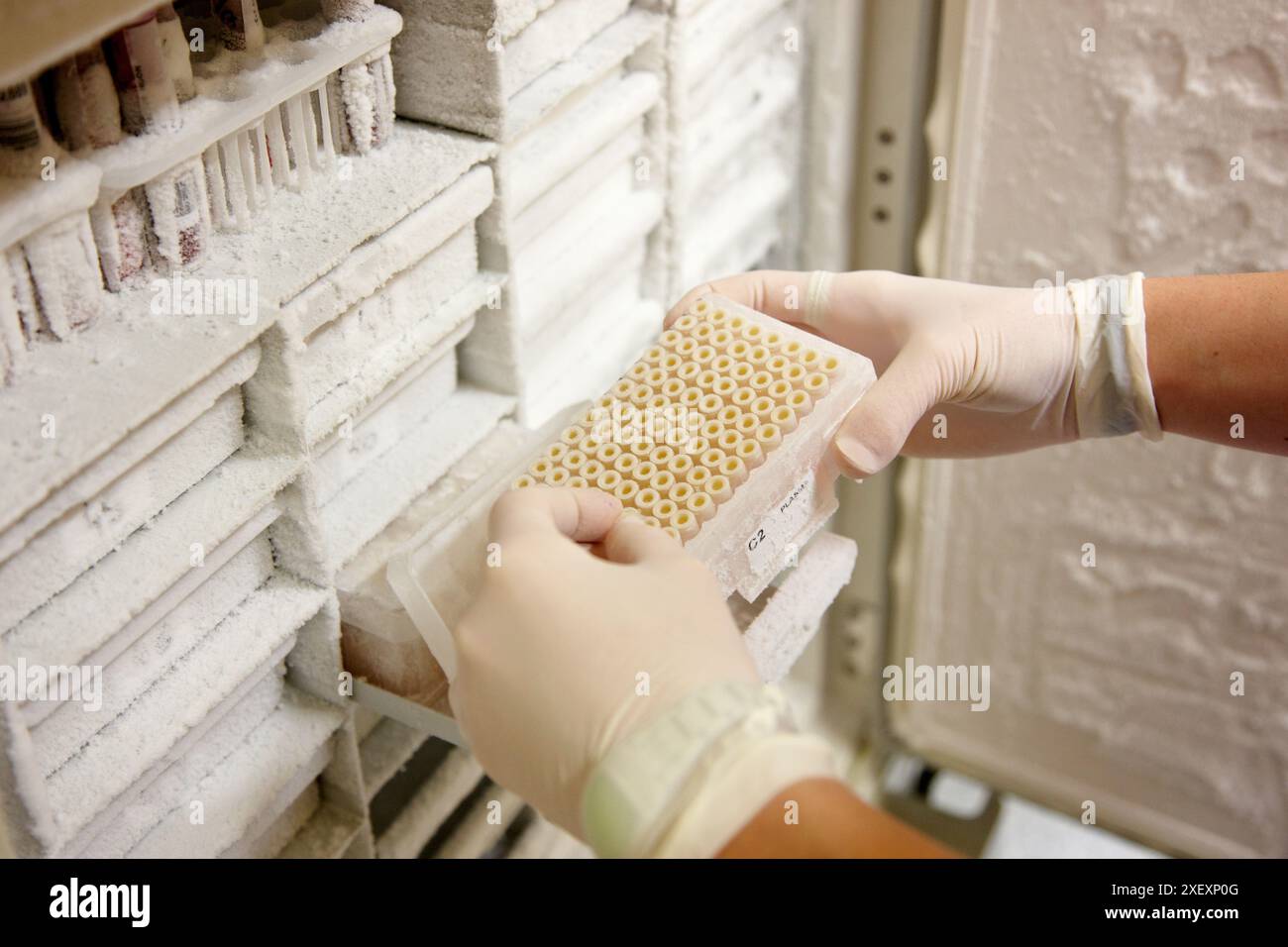 Stored samples in refrigerator at -80º C, DNA and RNA biobank ...