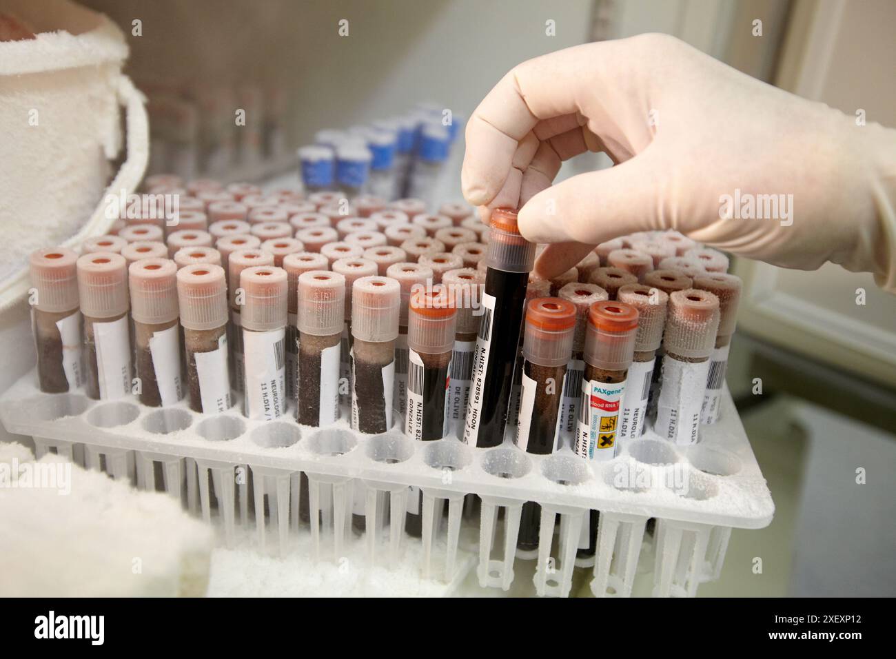 Frozen blood samples, stored samples in refrigerator at -80º C, DNA and ...