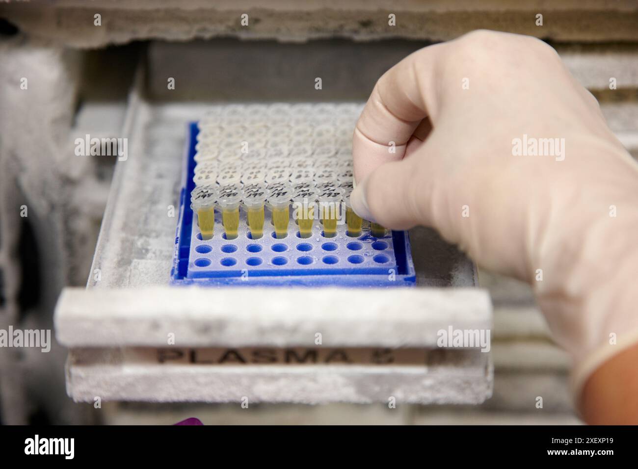 Frozen serum aliquots, stored samples in refrigerator at -80º C, DNA ...