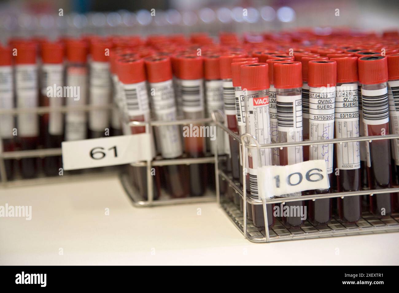 Blood samples, Laboratory of Diagnosis, Departamento de Producción y ...