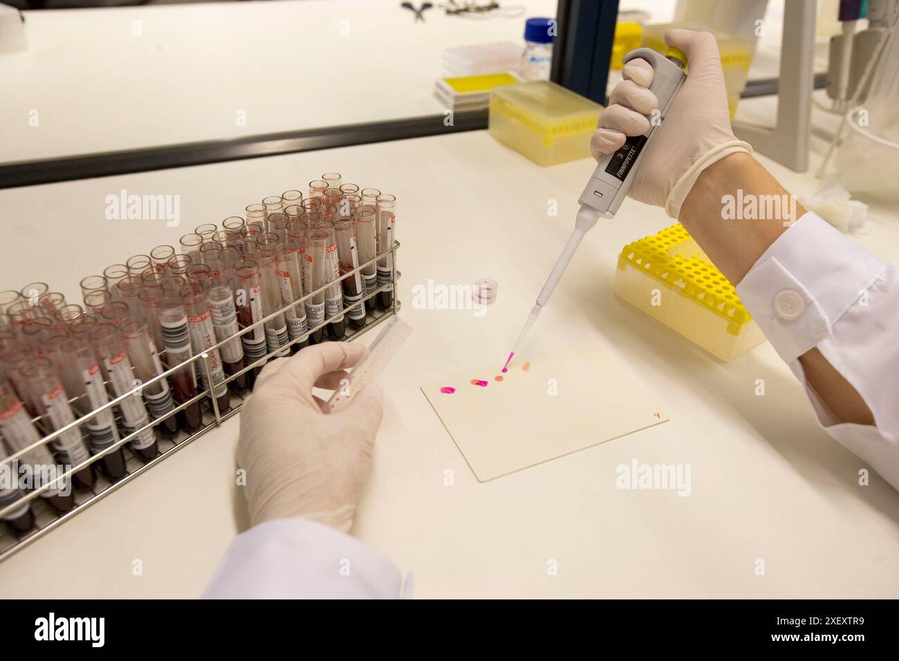 Rose Bengal test, Laboratory of Diagnosis, Departamento de Producción y ...