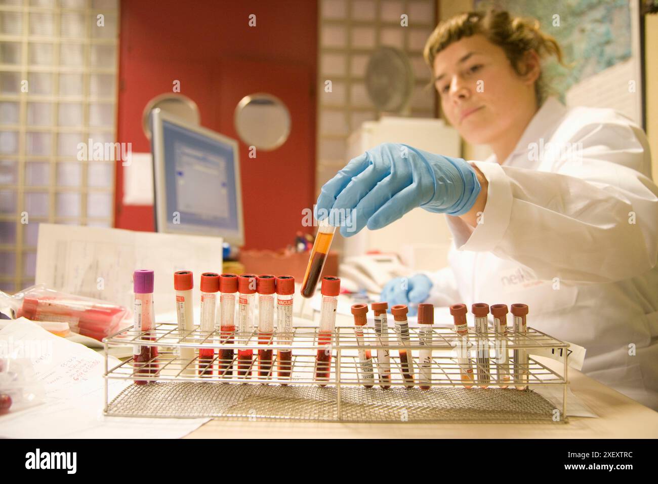 Reception of blood and serum samples, Neiker Tecnalia, Instituto de ...