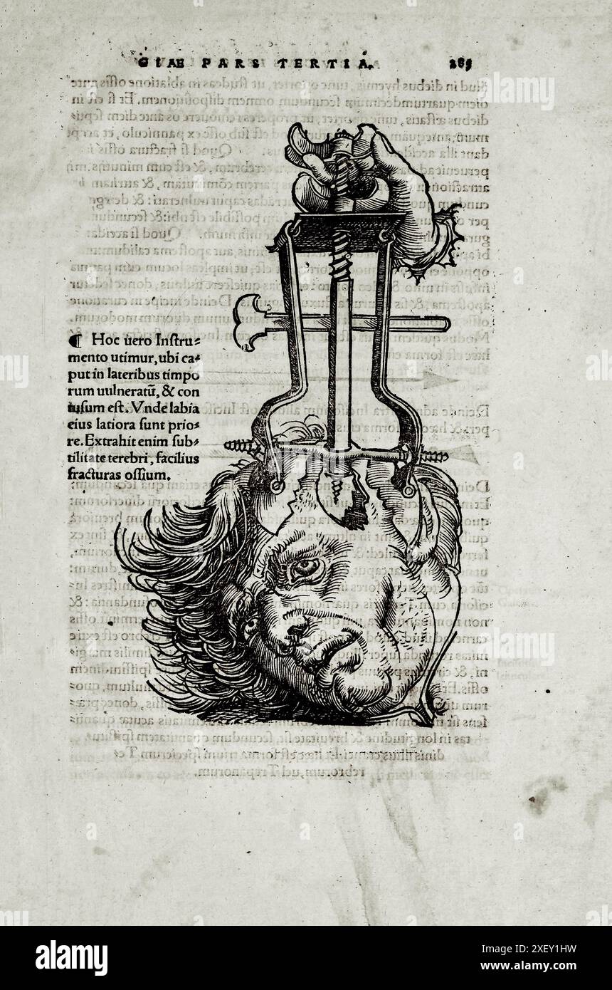 16th century medical instruments hi-res stock photography and images ...