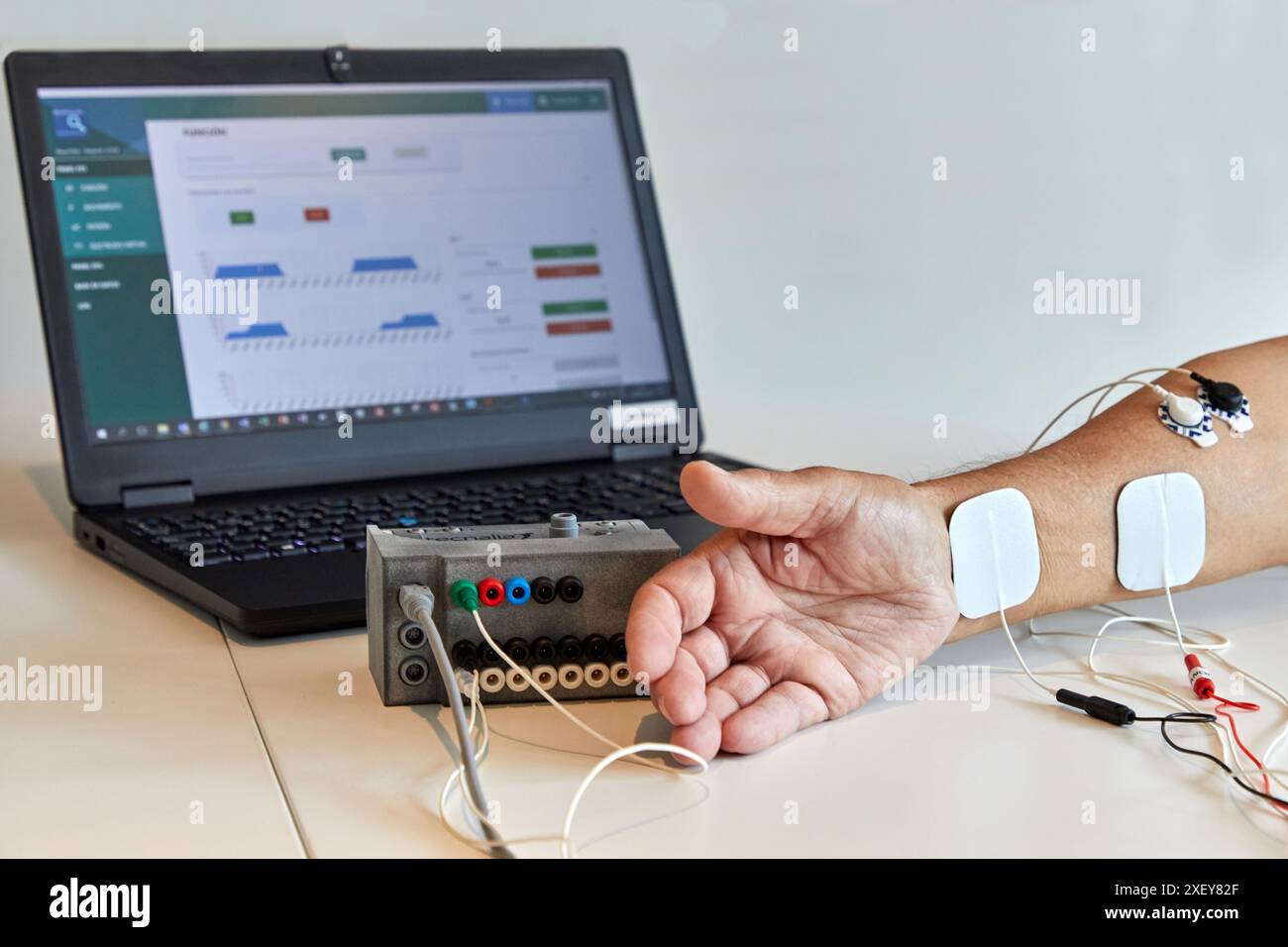 Neuromodulation system in closed loop hi-res stock photography and ...