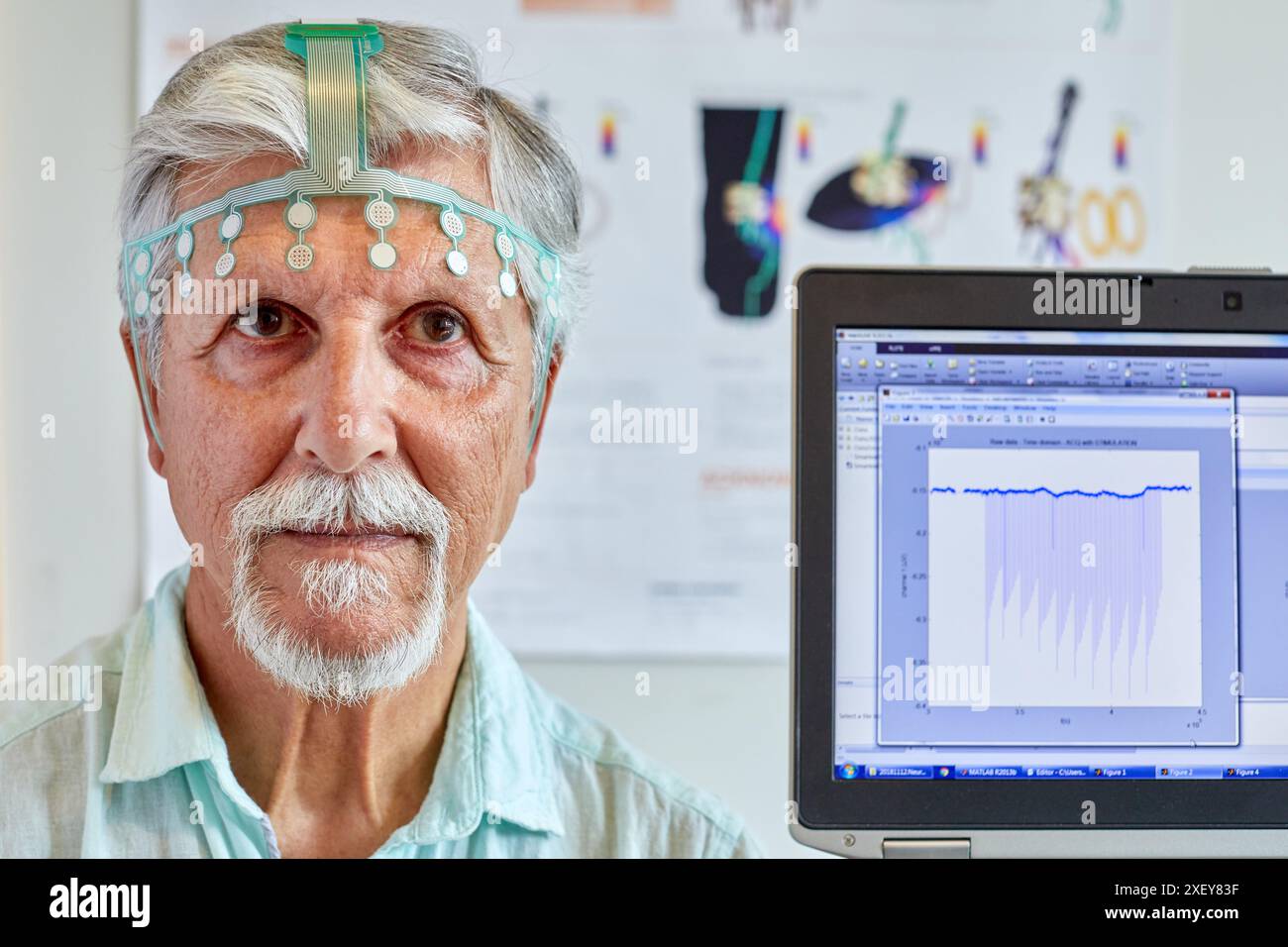 Neuromod, Neuromodulation system in closed loop for enhancing the sleep ...