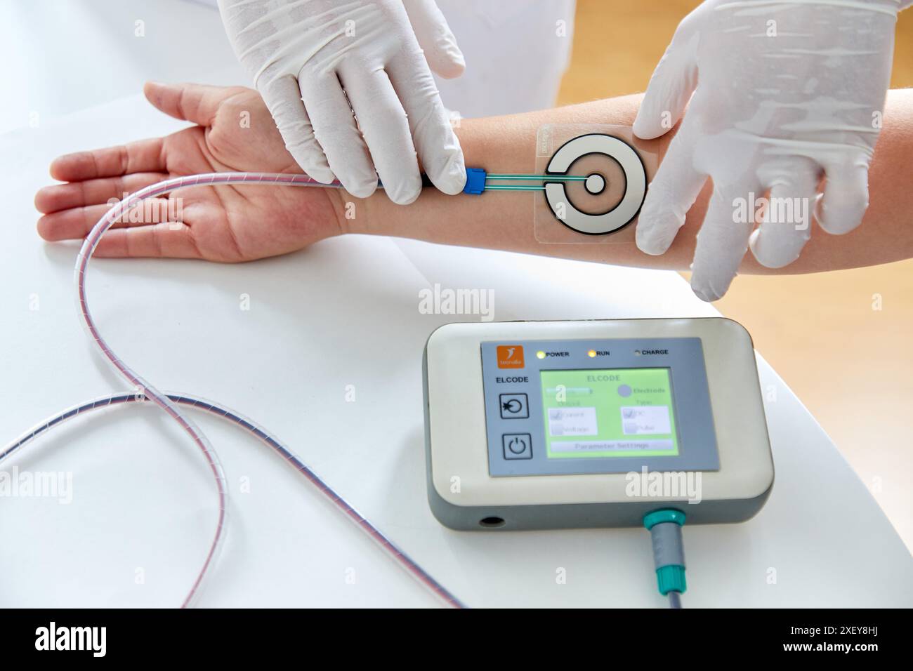 Elcode is a technological asset that consists of an electrode ...