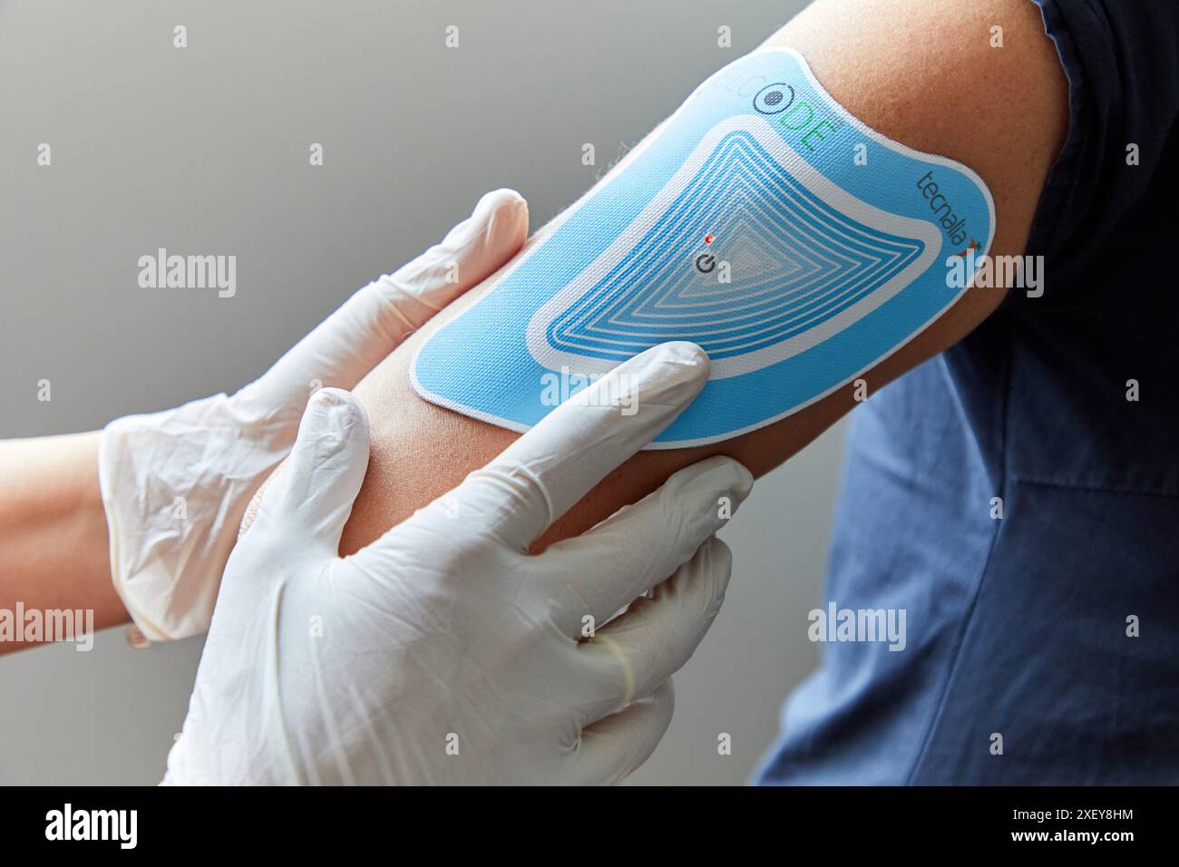 ELCODE, electrode-controlled transdermal drug delivery system based on ...