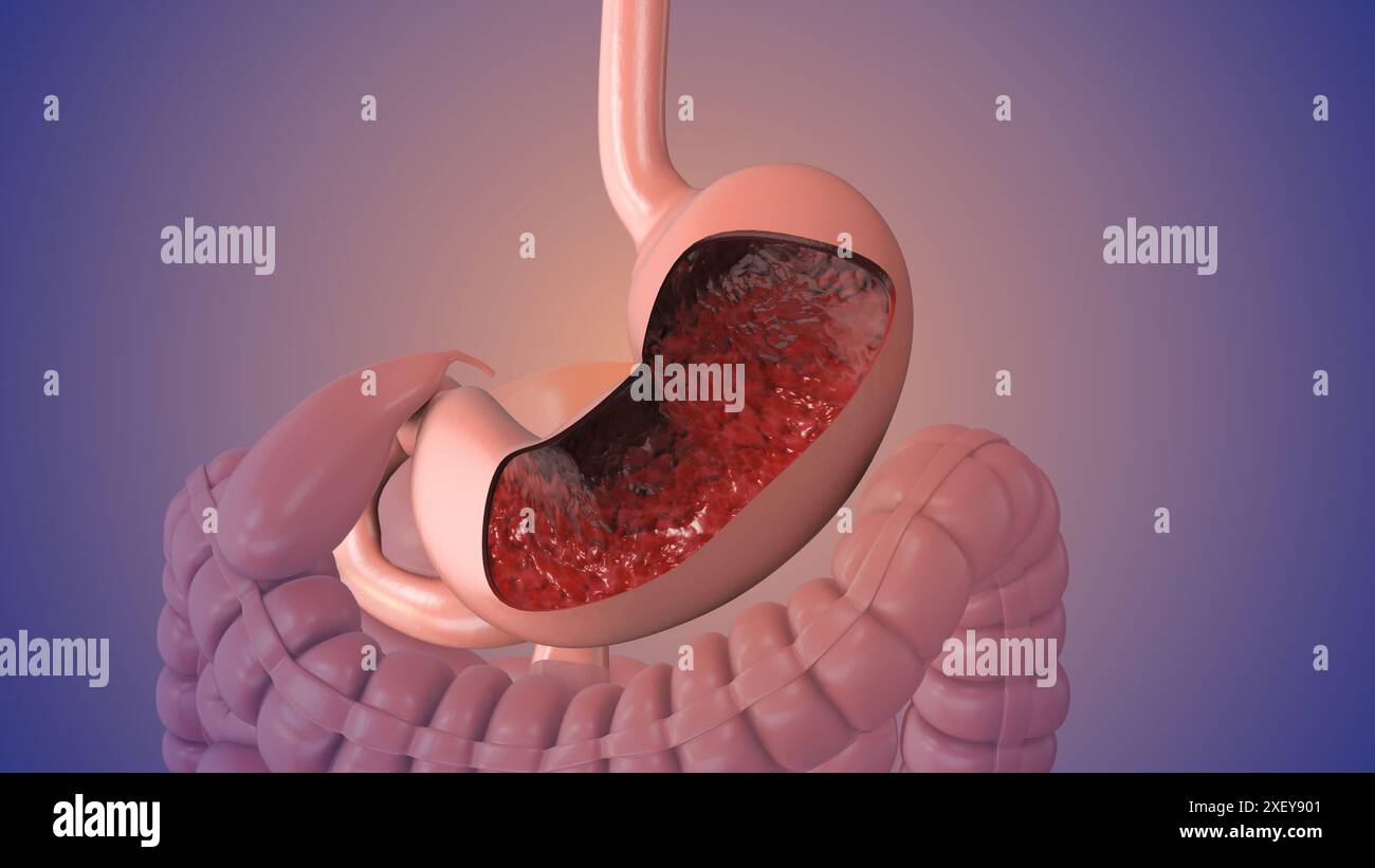Upper gastrointestinal endoscopy medical animation Stock Photo - Alamy