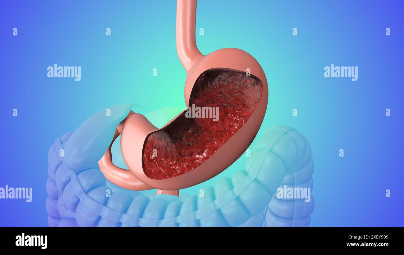 Upper gastrointestinal endoscopy medical animation Stock Photo - Alamy
