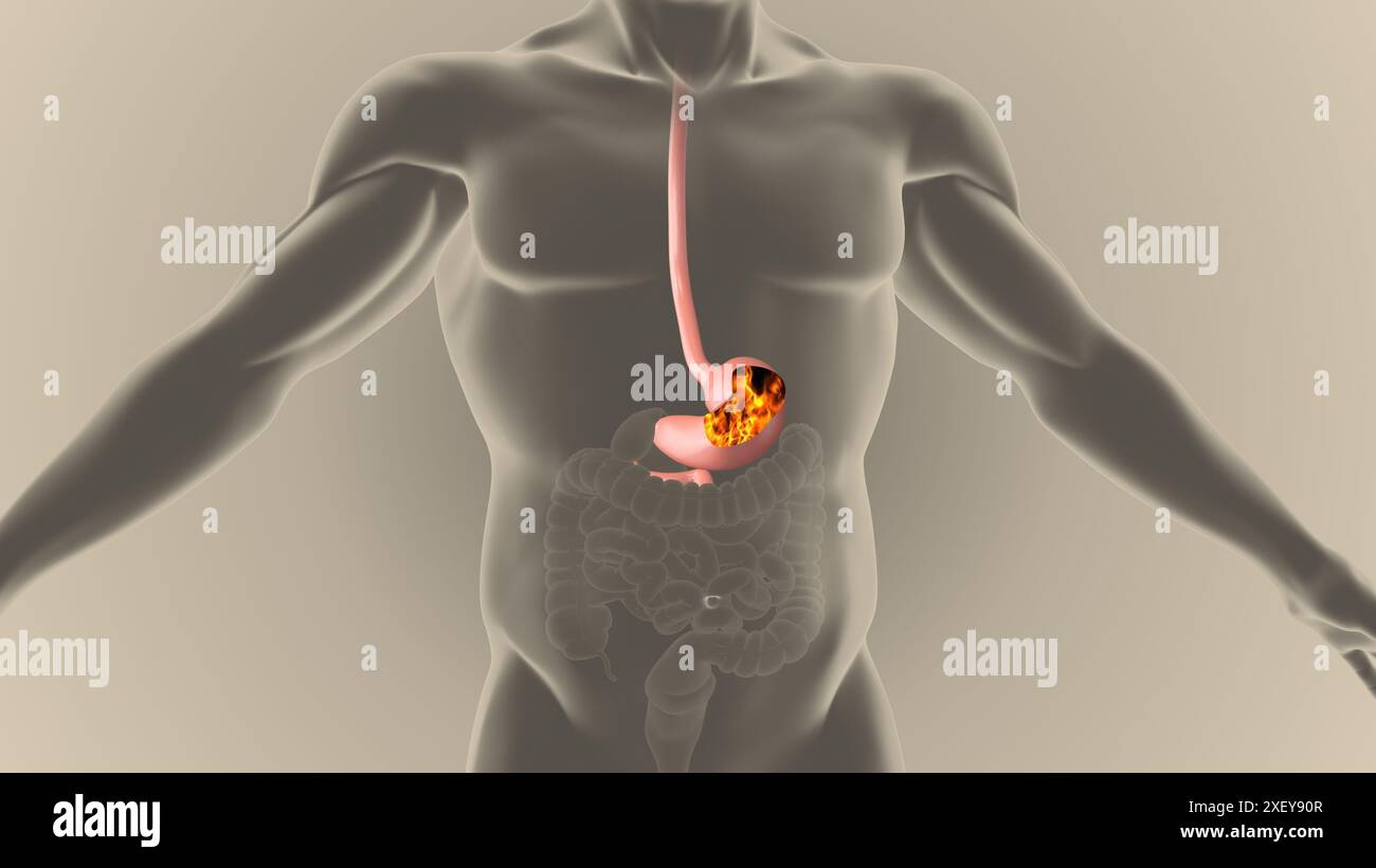 Stomach pain heartburn digestive disease hi-res stock photography and ...