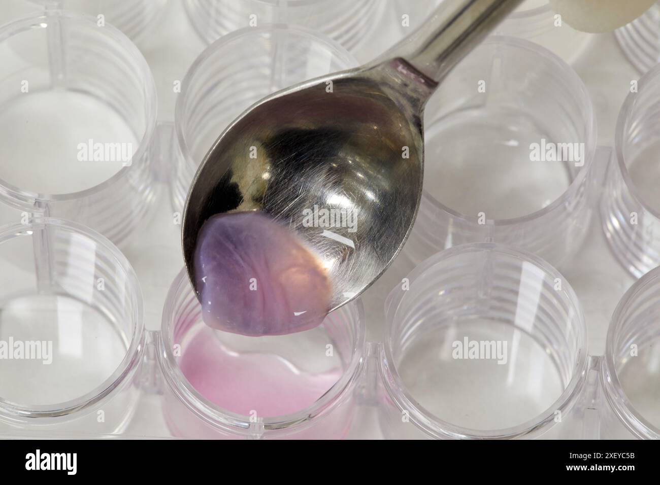 FATRIX, Decellularized regenerative matrix oriented to the treatment of ...