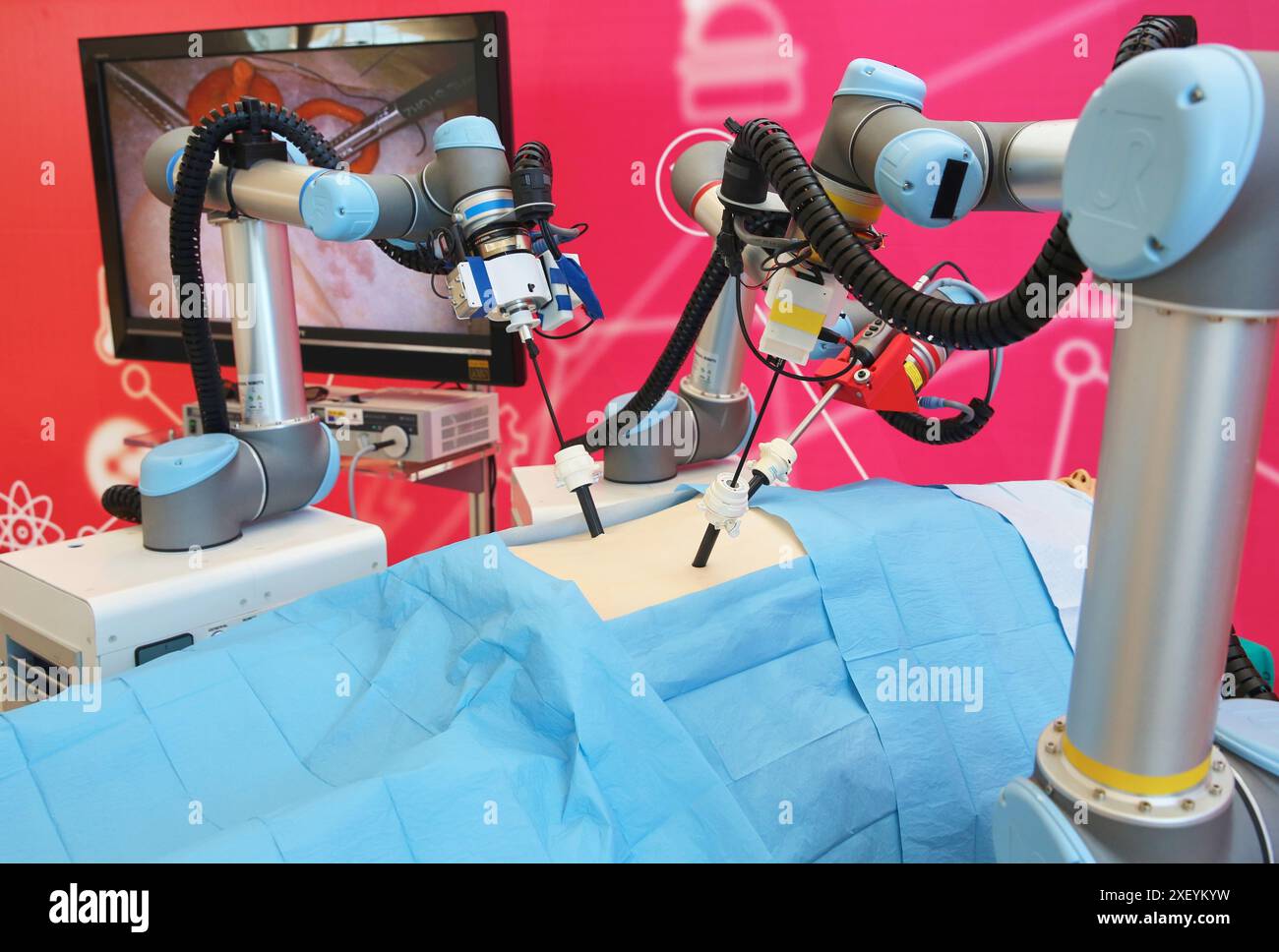 Development of a surgical robot with 3D vision and tactile sensations ...