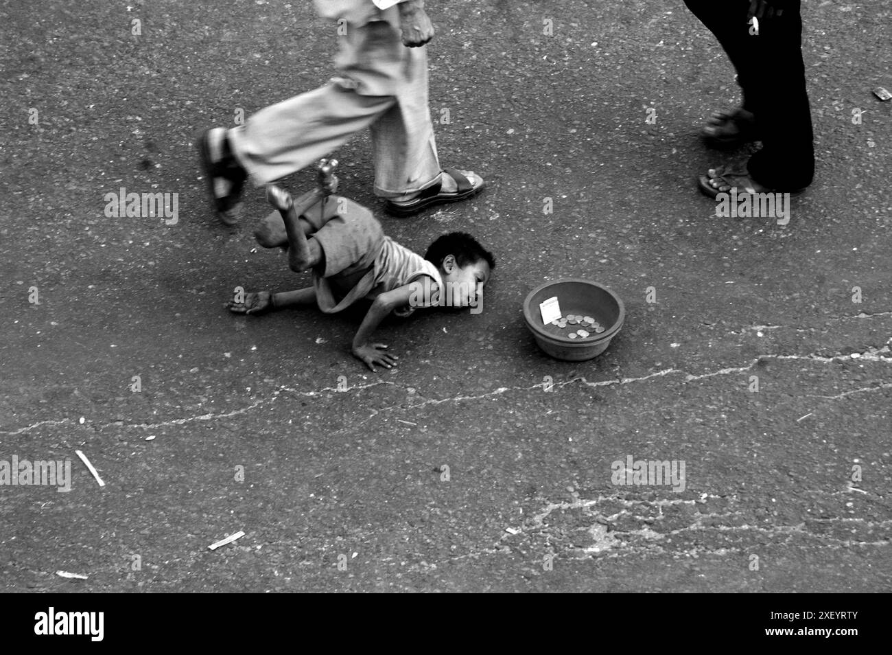 A disable child begging on streets, dhaka, Bangladesh. November 22 ...
