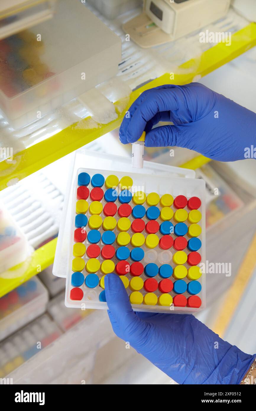 Experimental phase clinical trial, Storage of samples in freezer ...